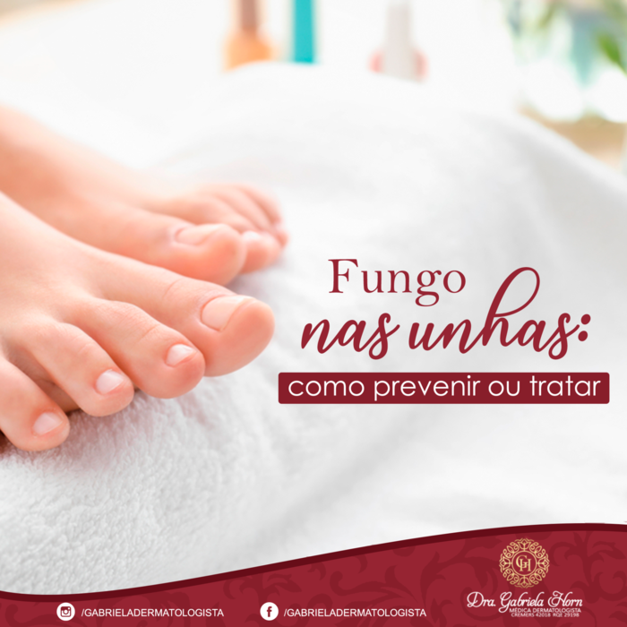 Fungo nas unhas: como prevenir e tratar